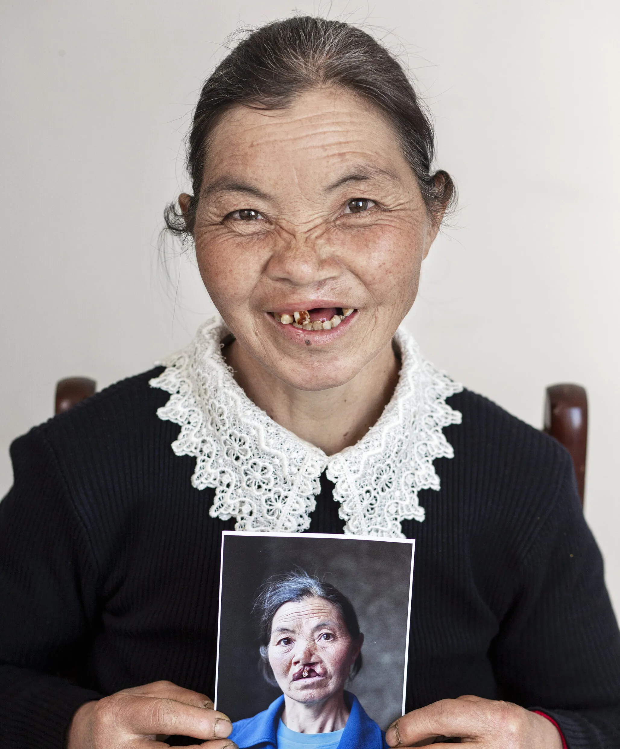 A Long-Awaited Transformation | Operation Smile