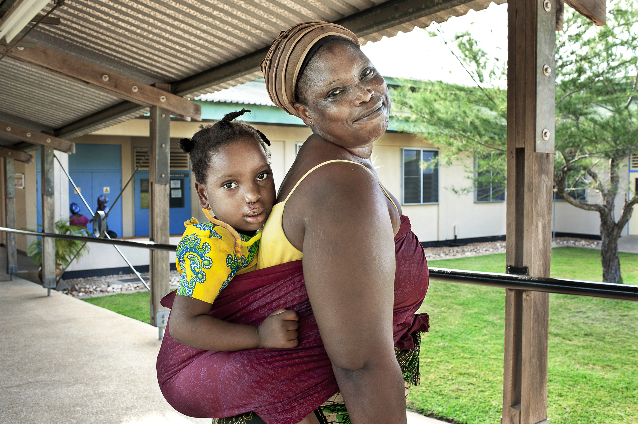 The Road to Ramata’s Smile | Operation Smile