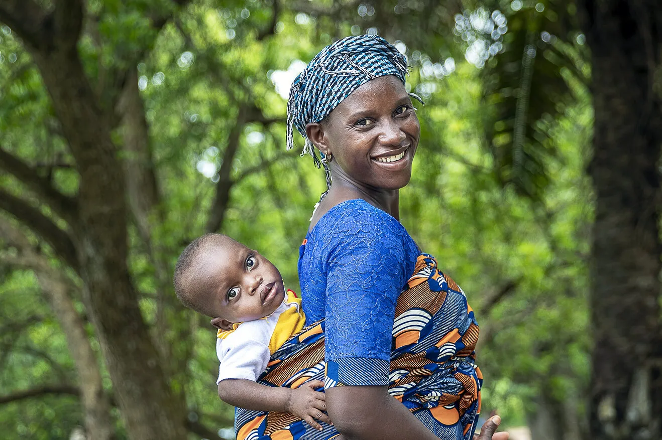 Moses’ Journey to Surgery | Operation Smile