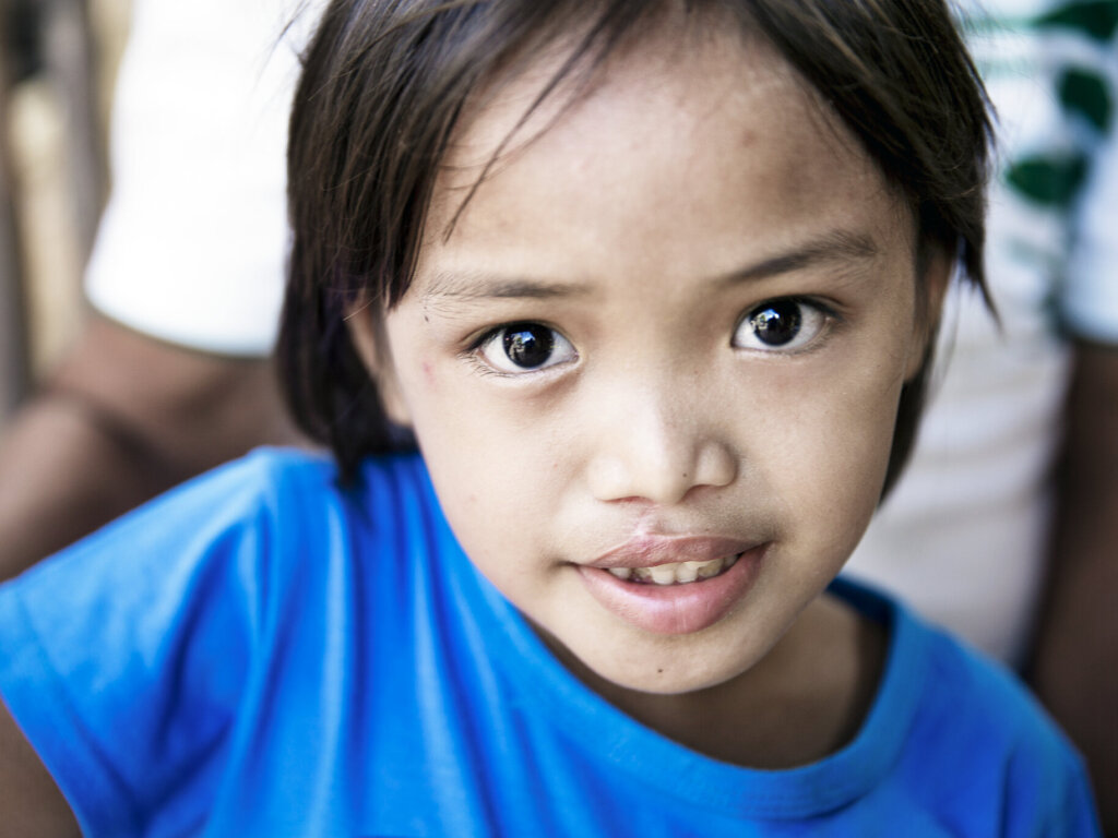 China | Operation Smile