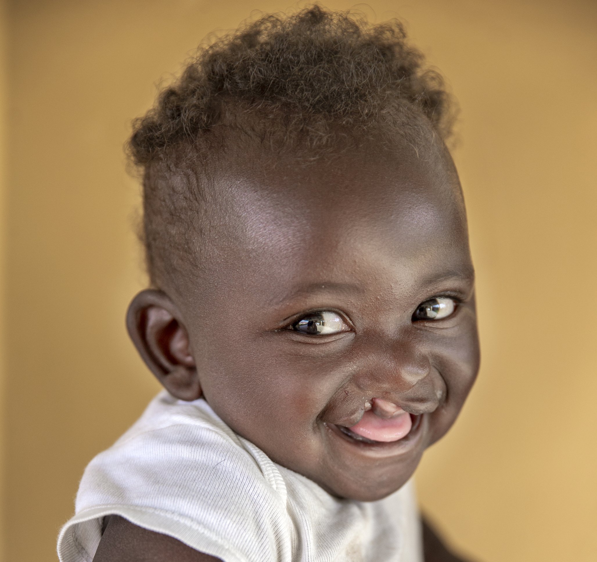 Meet Adolphe: A Bubbly Baby with Bright Eyes and a Brand-New Smile ...