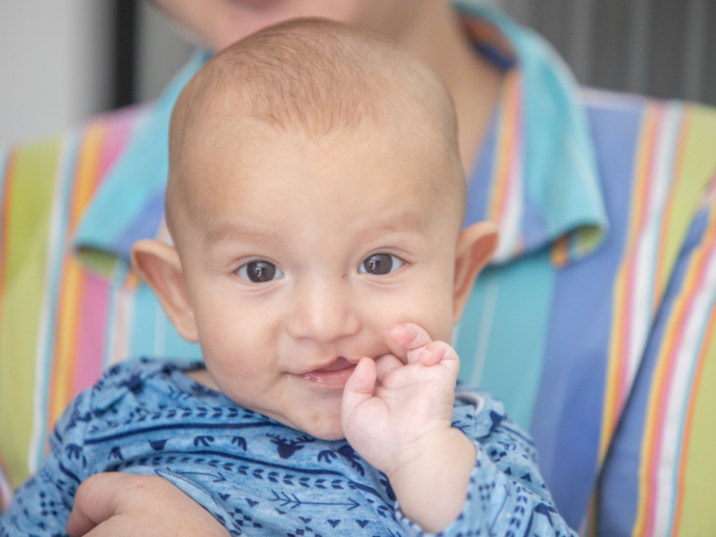What is Cleft Lip and Palate? Key Facts You Should Know | Operation Smile