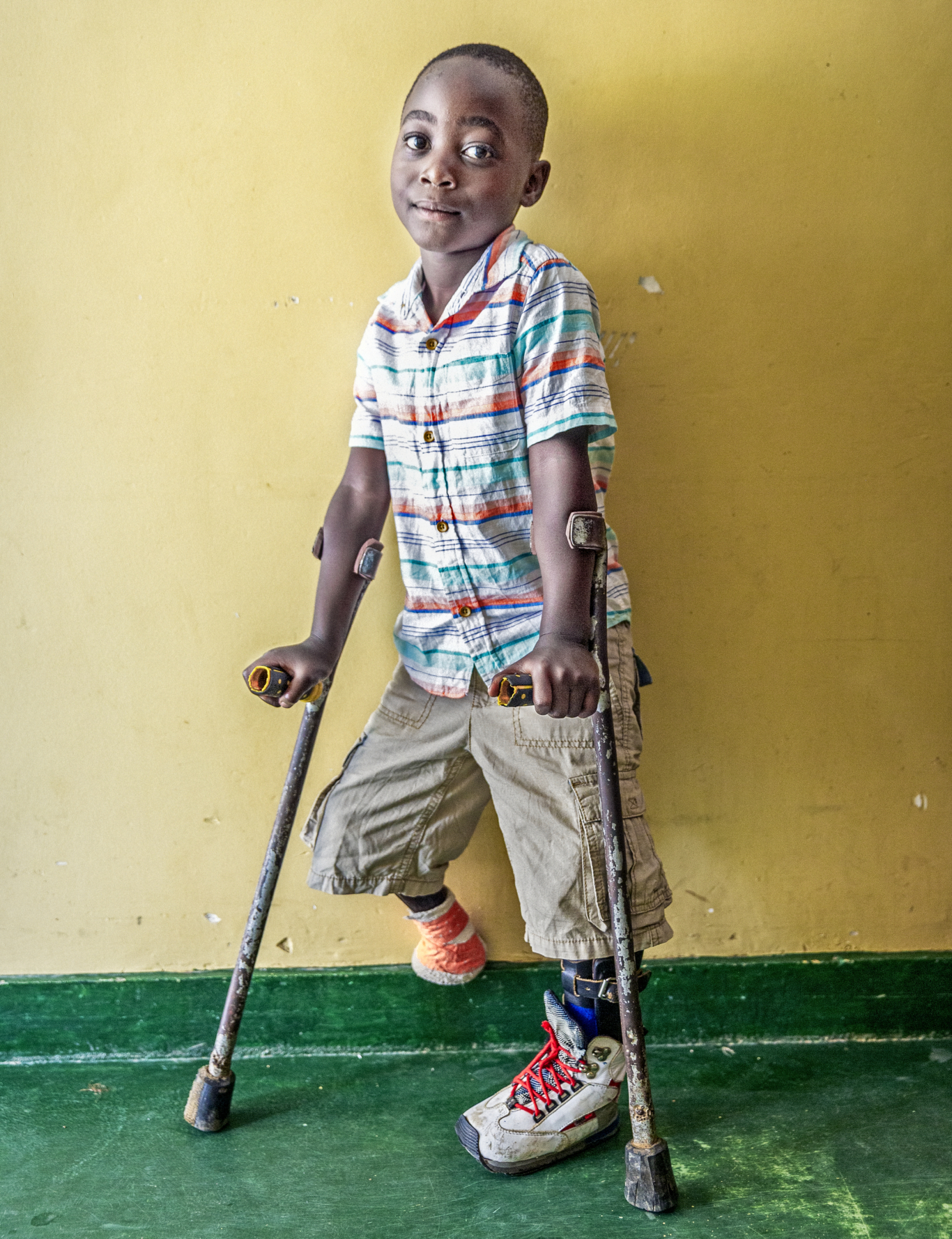 After a Tragic Burn Accident, a Young Boy Receives A New Lease On Life